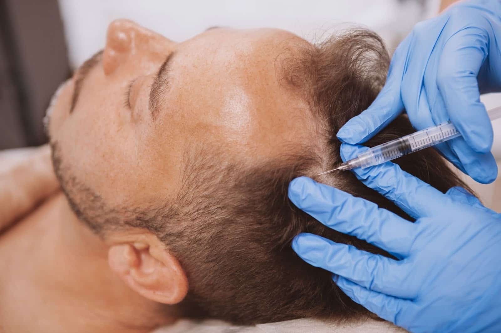 Hair Growth Cycle and How PRP Therapy Enhances Natural Hair Regrowth